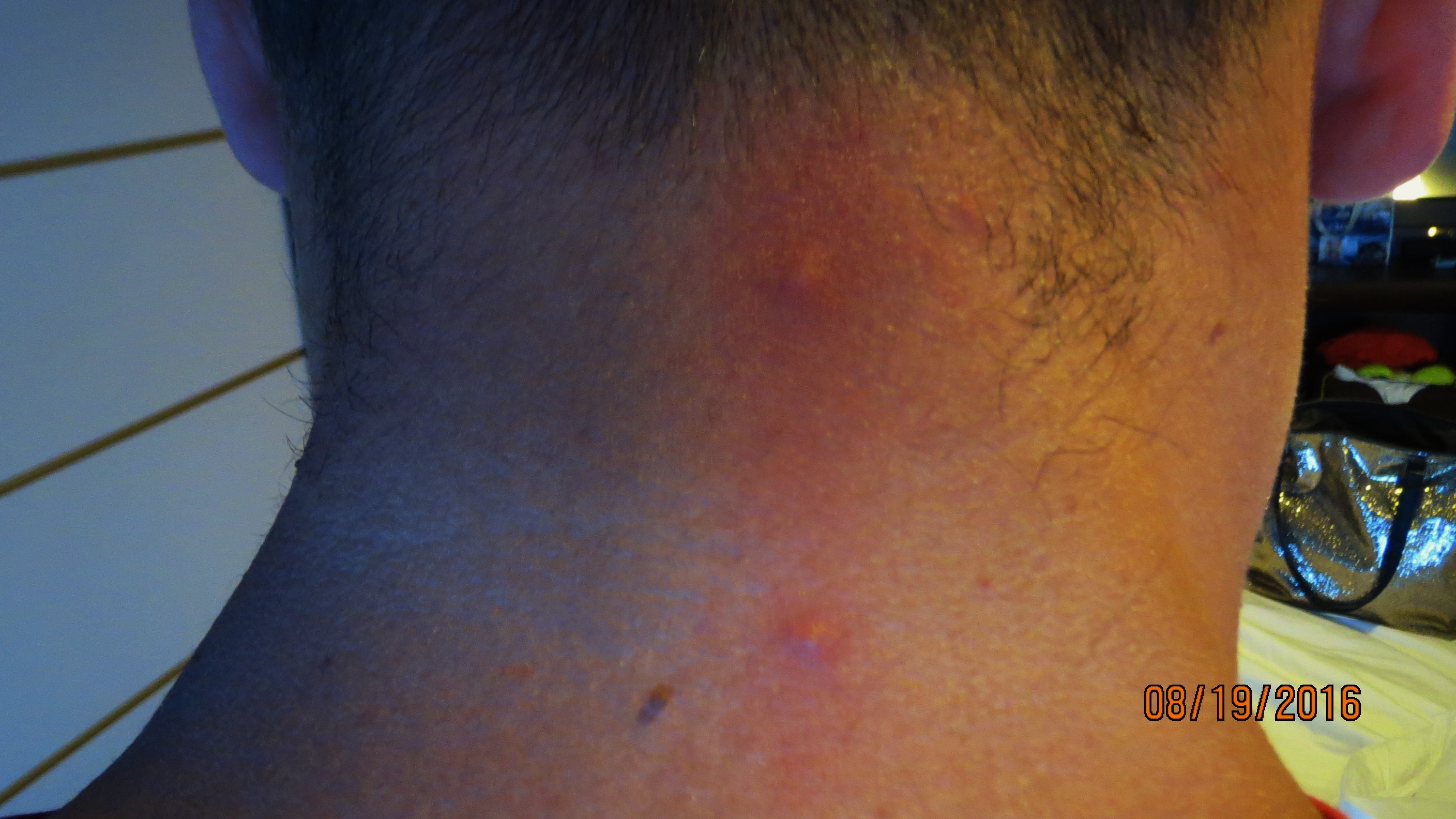 MSC Divina Bed Bugs - MSC Divina Cruise Review